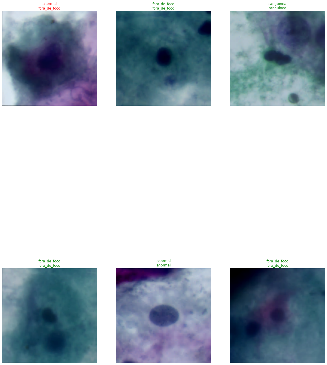 Lapix - Deep learning tutorials - ResNet Lapix - Deep learning tutorials - ResNet